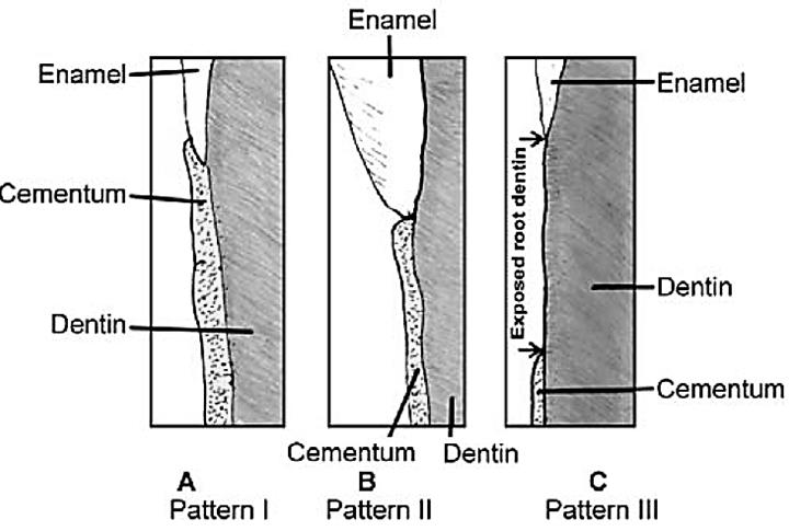 cementum structure (2) l Oral histology & biology MCQs for dental ...
