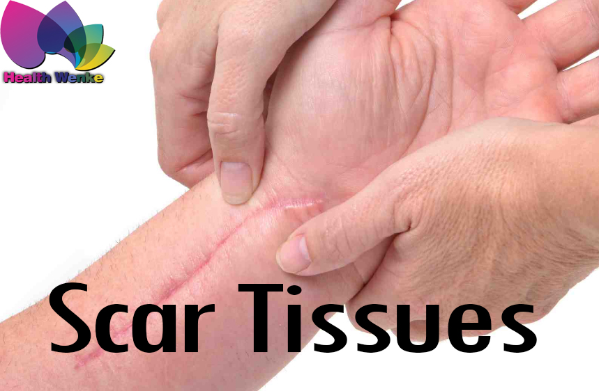 Home Remedies for Scar Tissues | HOW TO REMOVE OLD SCARS FROM FACE with ...