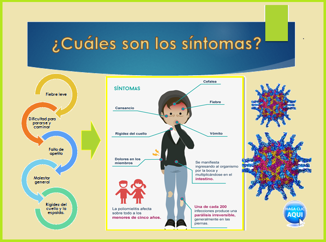Poliomielitis Causas Sntomas Y Tratamiento