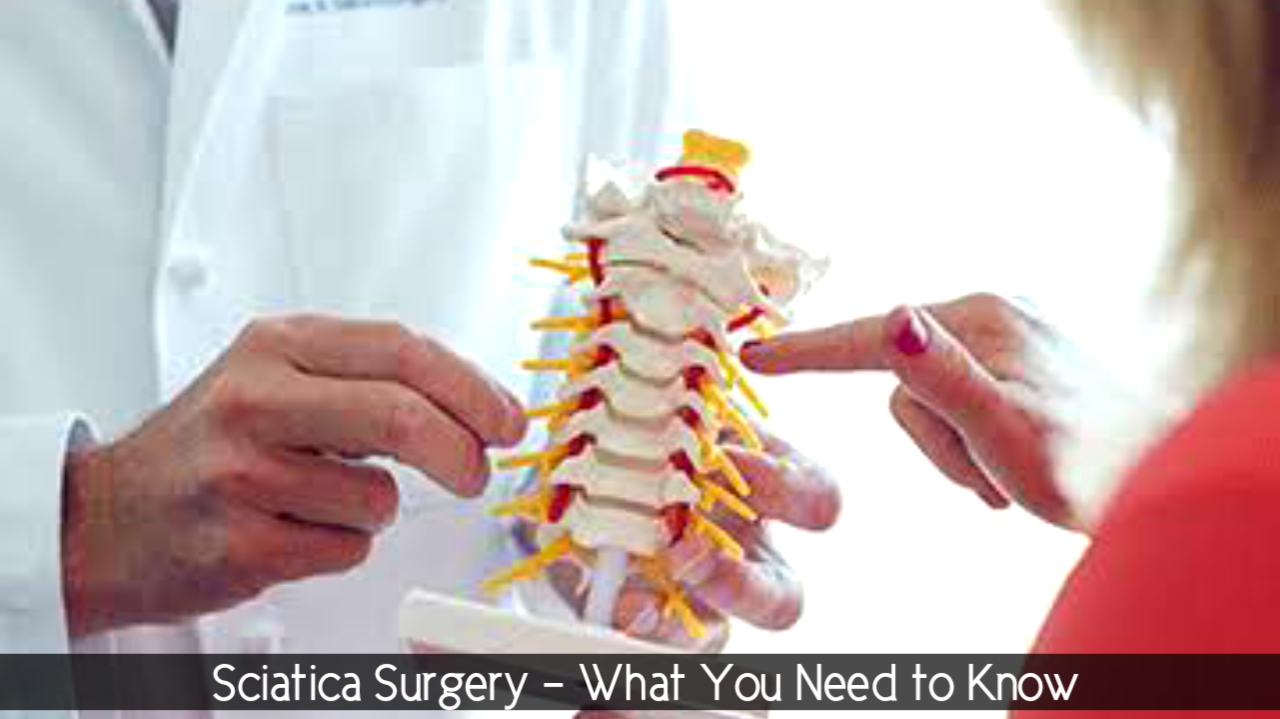 Sciatica Surgery - What You Need to Know - Healthy Tips