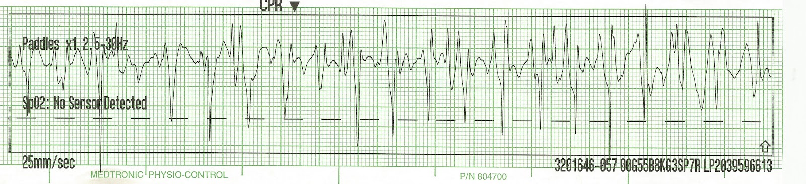 Float Nurse: Code Blue: Respiratory arrest