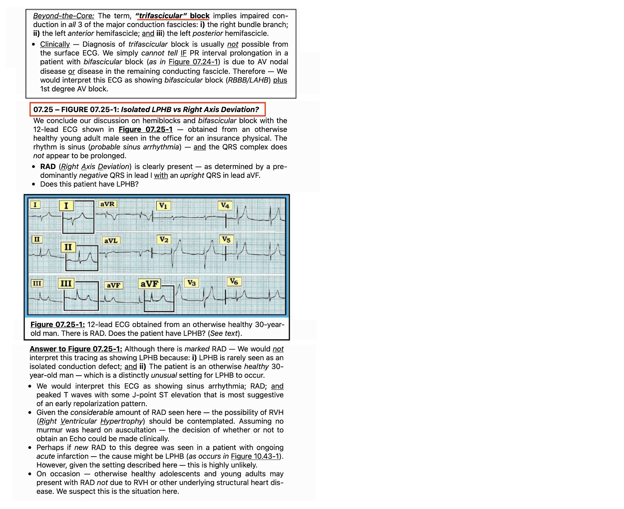 Ecg Interpretation Ecg Blog 205 — What Is Trifascicular Block