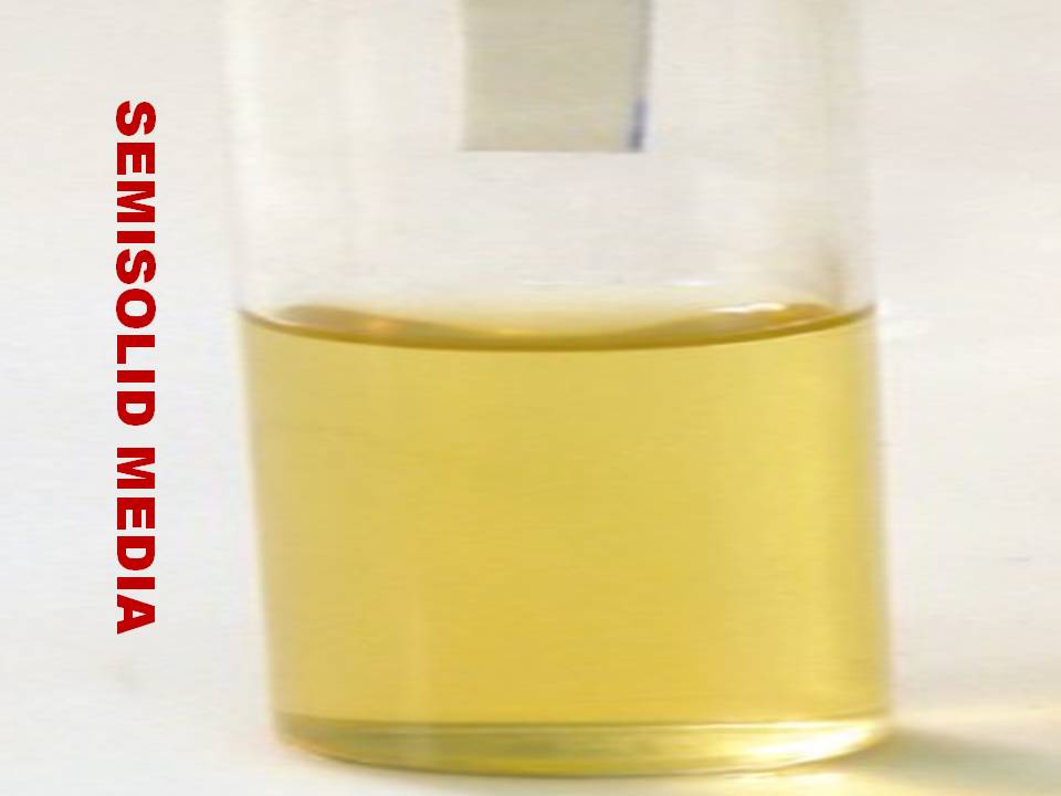 TYPES OF CULTURE MEDIA IN MICROBIOLOGY