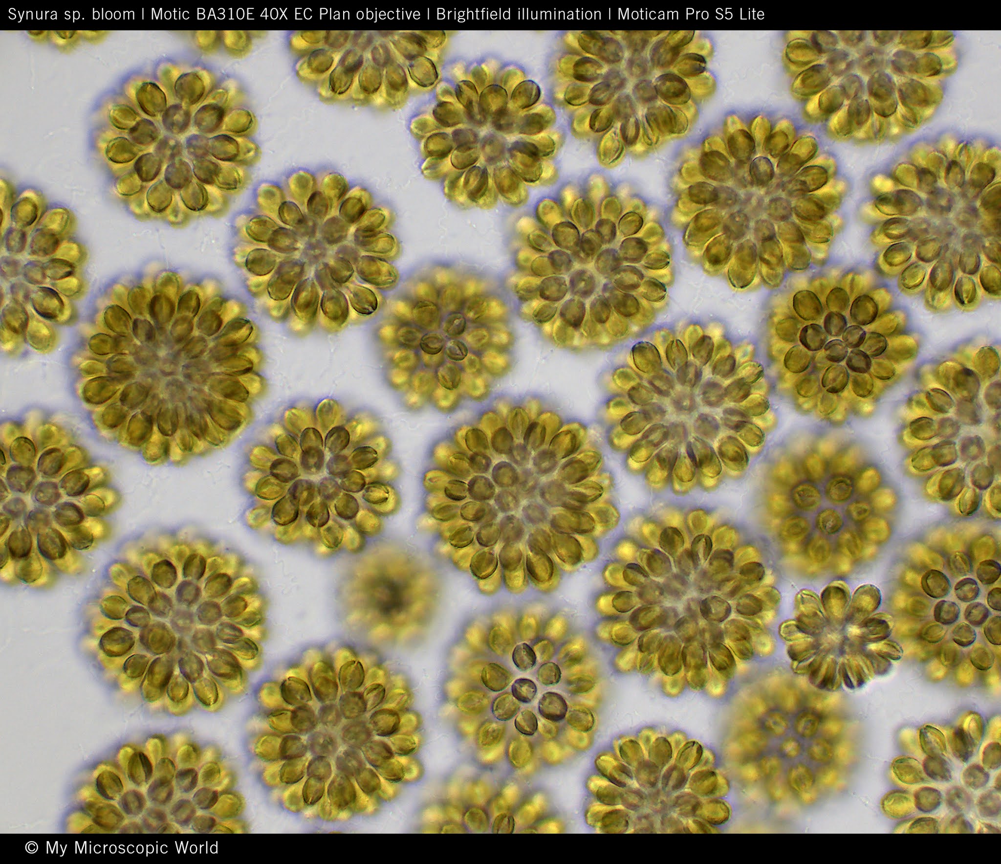 Algal Blooms Under Microscope