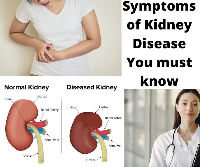 10+ Symptoms of Kidney problems You should know