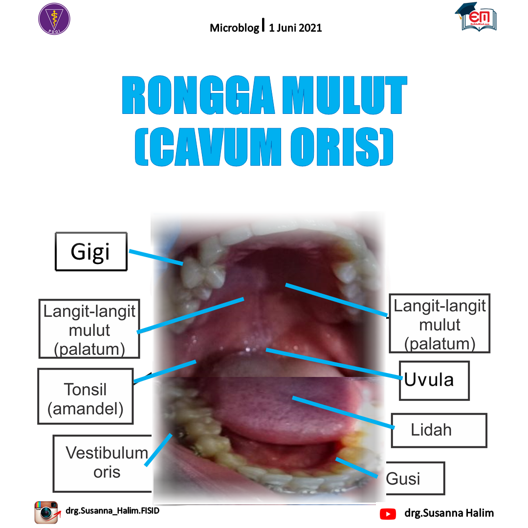 PERIODONTITIS BISA MENJADI TANDA AWAL DARI PENYAKIT DIABETES MELLITUS
