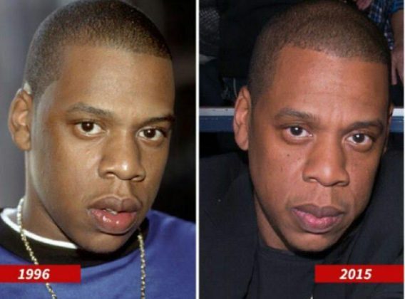 Jay Z before and after(photo)