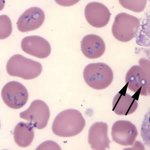 Themes of Parasitology: Babesii microti: the Protozoan Plasmodium