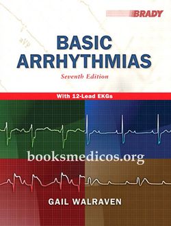 Basic Arrhythmia 7th Edition, Gail Walraven | booksmedicos