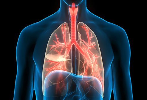 Medicine, Communication, and Research Portals: WHAT IS BRONCHITIS ...