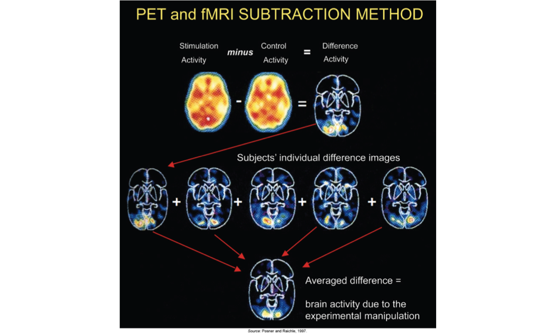 Head of Neuroscience: fMRI Activation map and Subtraction