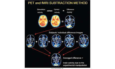 Head of Neuroscience: fMRI Activation map and Subtraction