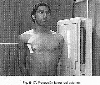 Tecnicas Radiológicas 2011: Esternón Proyección Lateral Posición D o I ...