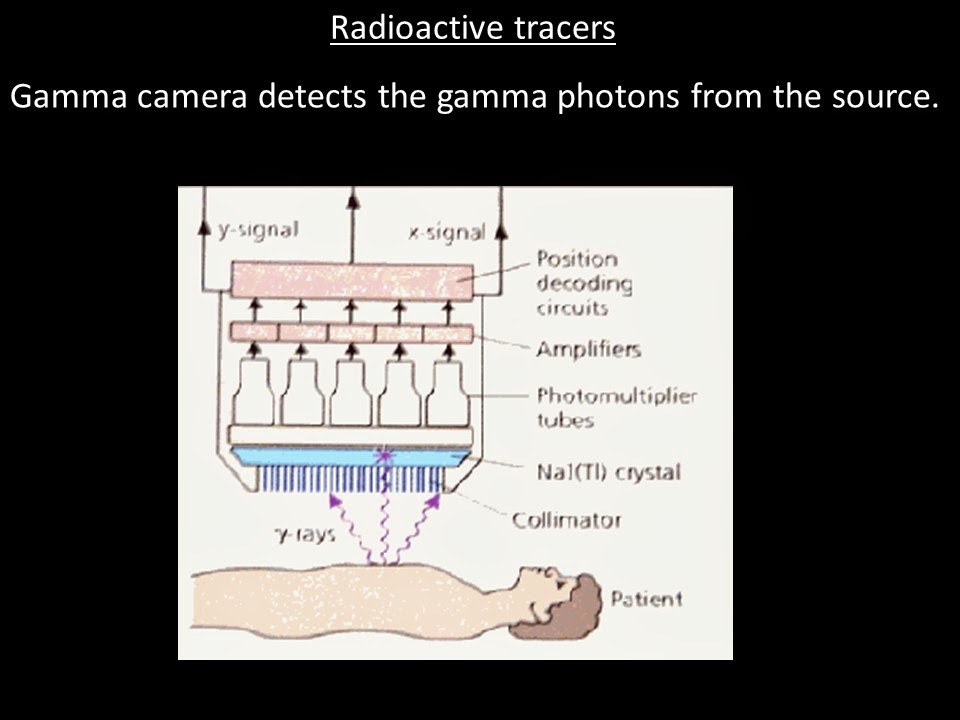 Mr Lloyd's Interactive Board: Y13 Radioactive tracers and the Gamma Camera