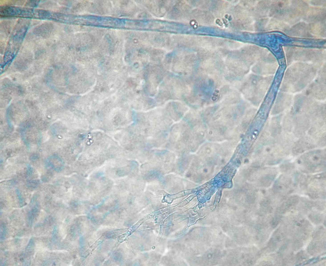ATLAS MICOLOGIA: SYNCEPHALASTRUM RACEMOSUM