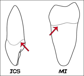 Introdução à Anatomia Dental Parte #4 - Características Comuns Entre os ...