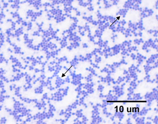 Nadi_Biologi: Staphylococcus epidermidis