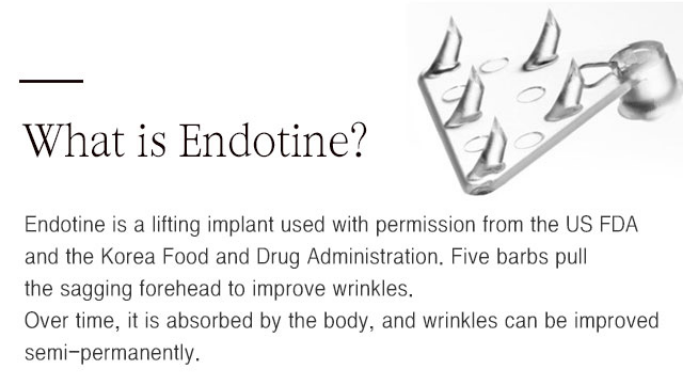 Faceline's Endotine Lifting _Saggy eyes, forehead wrinkles are lifted ...