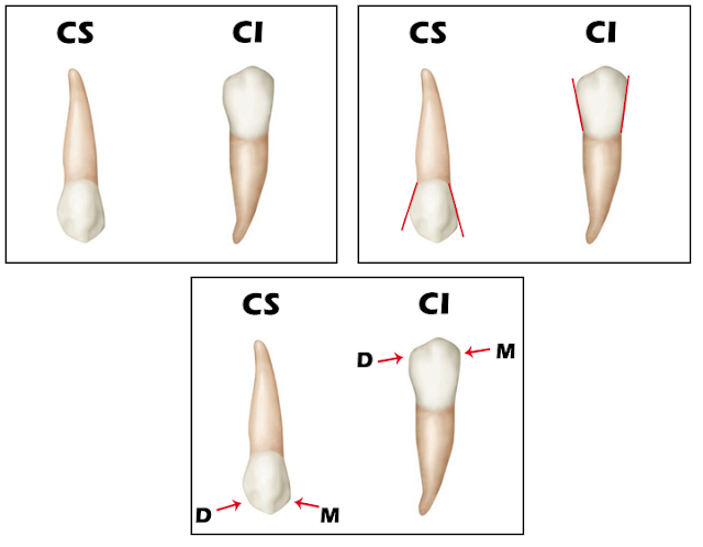 Aula de Anatomia Dental - Canino Superior - Dente 13 e 23