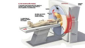 ANATOMÍA Y RAQUEL: TAC o tomografía axial computerizada.
