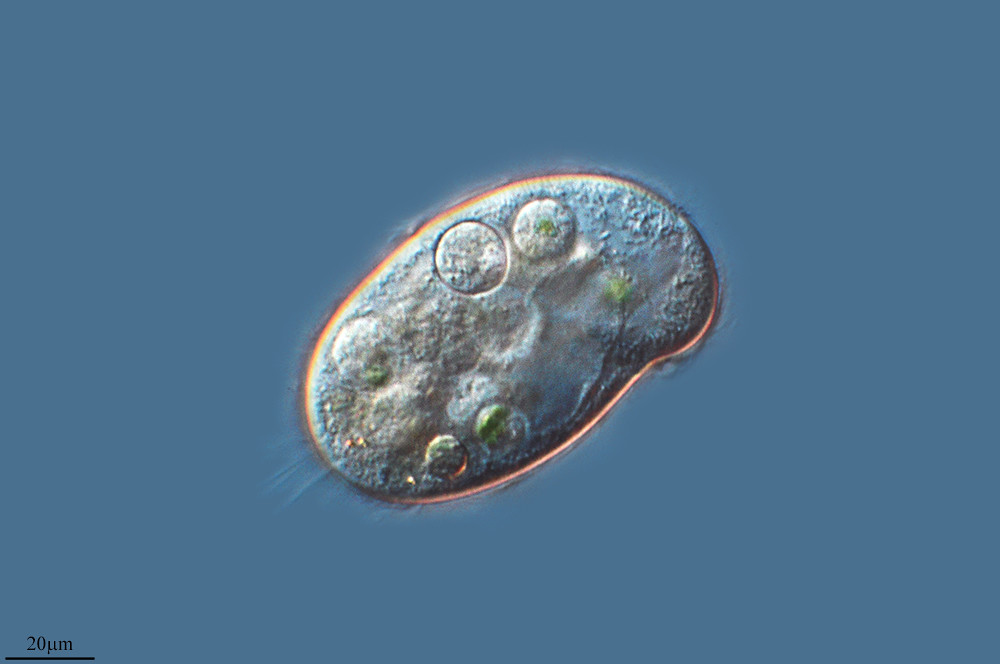PROTOZOARIOS