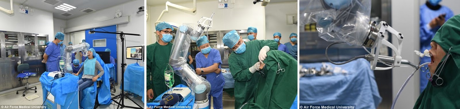 First automated robotic dental procedure in China