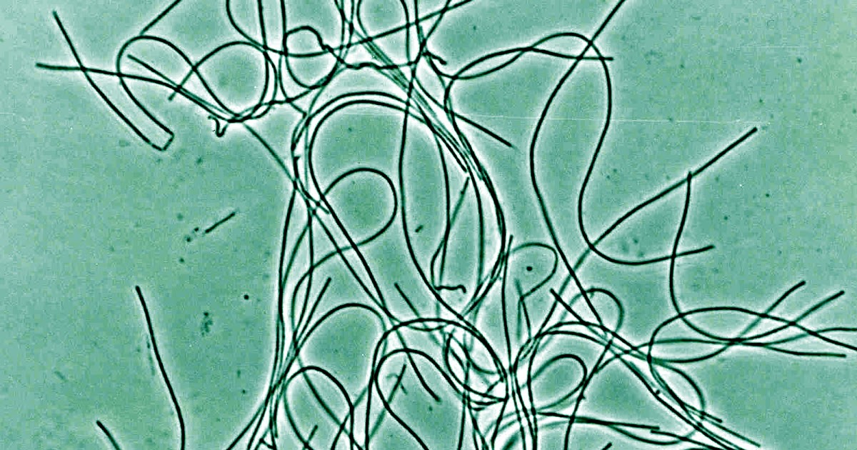 Características del Dominio Bacteria: Características del Dominio Bacteria.
