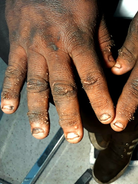 EL RINCÓN DE LA MEDICINA INTERNA. juanpedromacaluso@yahoo.com.ar: 15 ...