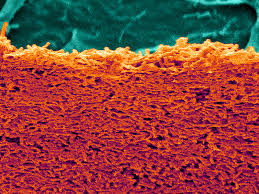 MATHEWS OPEN ACCESS JOURNALS: FDA Approves Zinplava