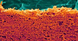 MATHEWS OPEN ACCESS JOURNALS: FDA Approves Zinplava