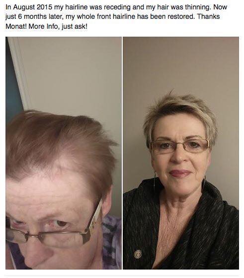 Monat Restores, Repairs and Regrows Hair!: See the shine and growth on ...