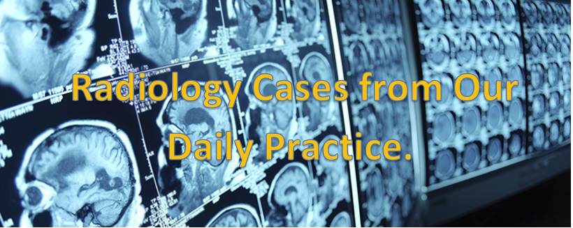 Radiology Cases: Case #1