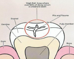 YÜZEYDEKİ OLUŞUMLARIN MORFOLOJİLERİ