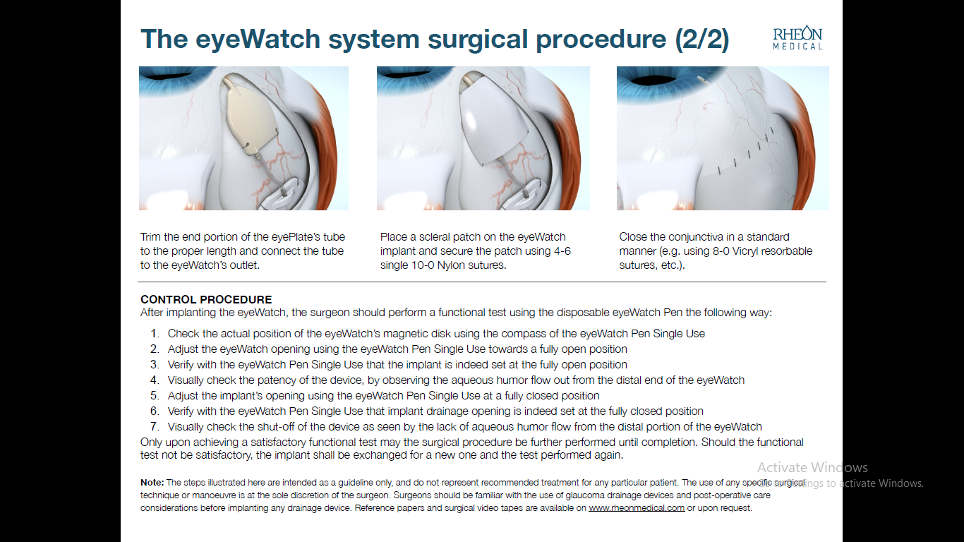 GLAUCOMA SPECIALIST BLOG: "THE GLOG"