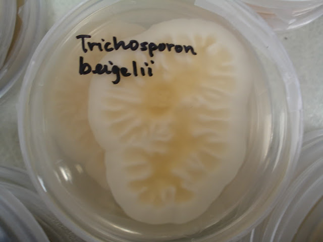 Lecture Notes in Medical Technology: Lecture #16: INTRODUCTION TO MYCOLOGY