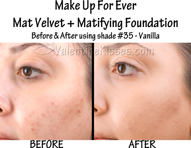 Yarnandbeauty: The Best Mattifying Products for Severely Oily Skin