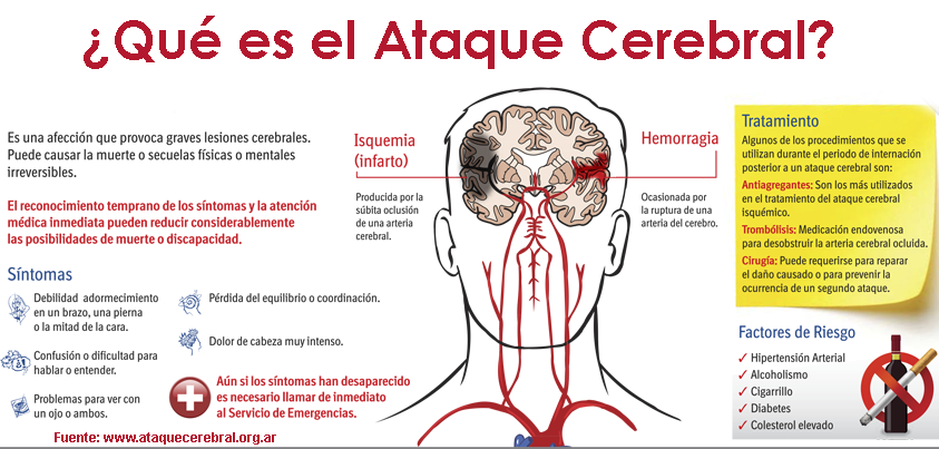 notifé: Prevención del ataque cerebral (ACV)