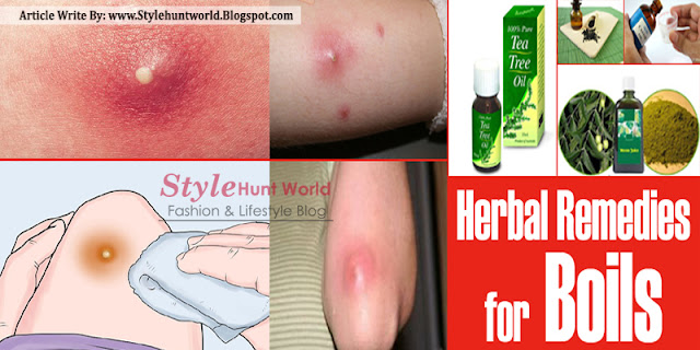 How Get Rid Of Boils Very Fast - Herbal Remedies for Boils - Style Hunt ...