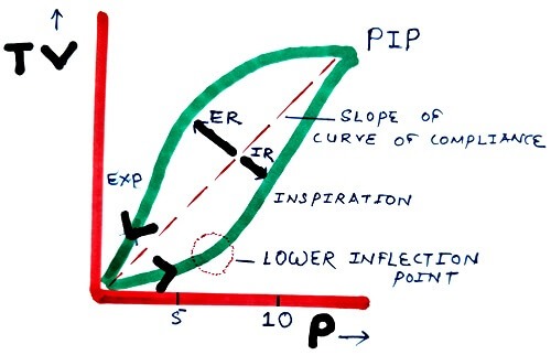 Ventilator Graphics Made Easy