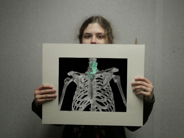 Resplendency Revealed: There's a Frog in My Throat! - X Ray Project