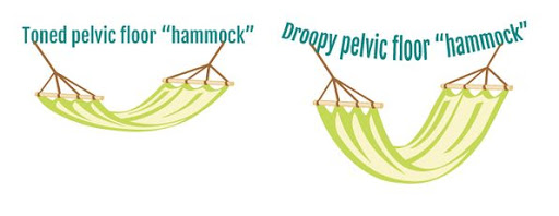 DROOPY PELVIC FLOOR