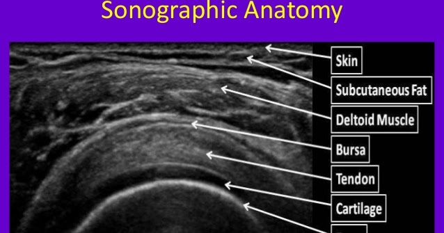 HOW TO GIVE SHOULDER JOINT INJECTION USING MEDICAL ULTRASOUND