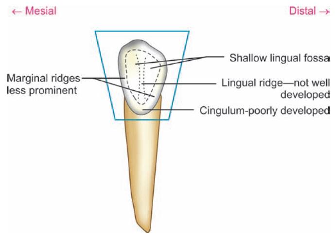 Permanent mandibular canines l tooth crown & root morphology revision ...
