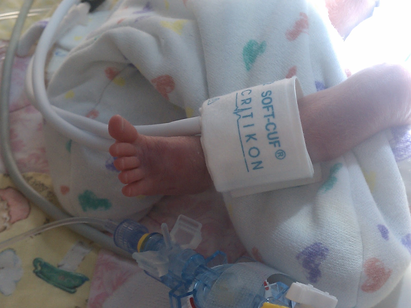 Avery's Adventure: Day 10 in the NICU- September 8, 2012