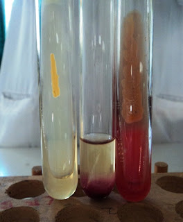 Identifikasi Bakteri Gram Positif dan Gram Negatif ~ Analis Kesehatan ...