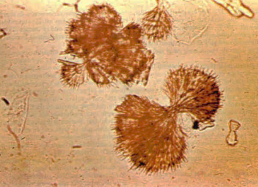 Blog del Laboratorio clinico : Cristales de sulfamida