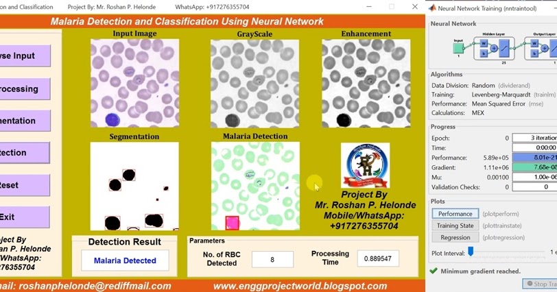 Malaria Detection from Blood Cell Using Neural Network Matlab Project ...