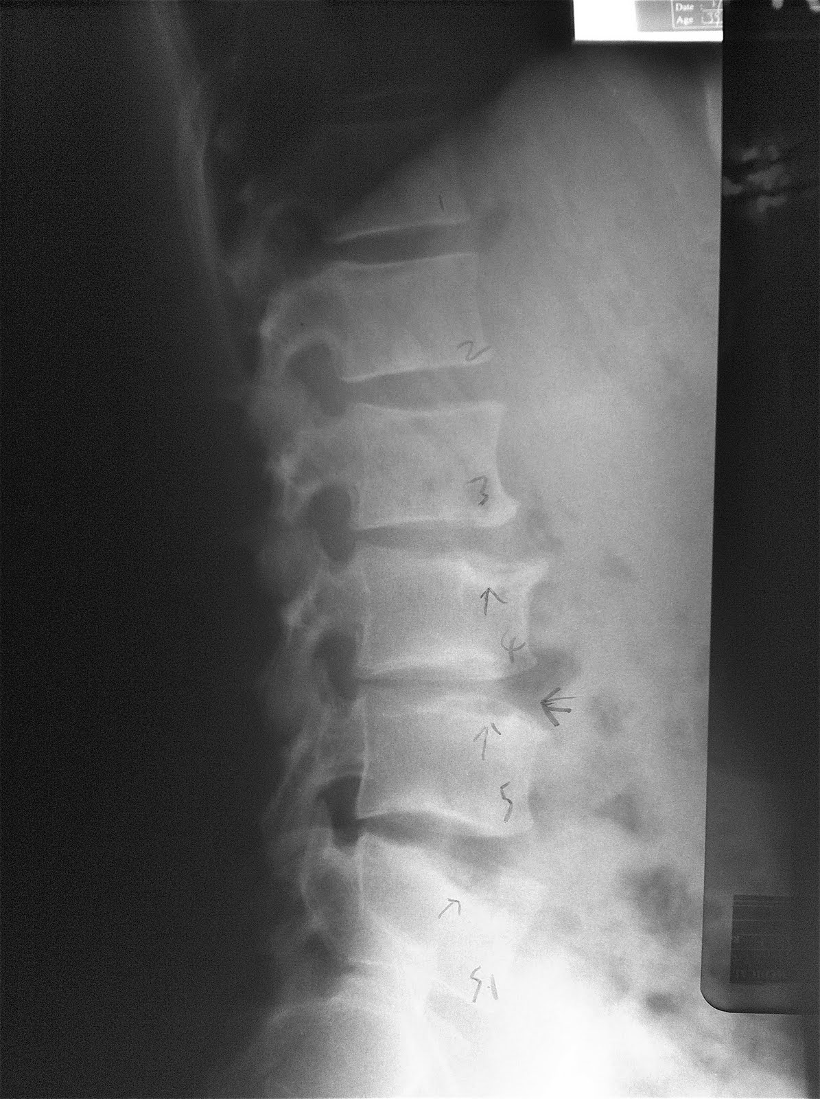 MedView Medical Imaging Consultancy Info Page: Dealing with normal ...