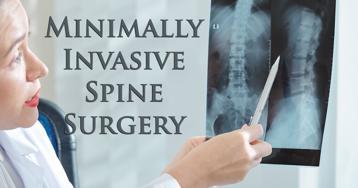 What Is Minimally Invasive Spine Surgery El Paso, Texas?
