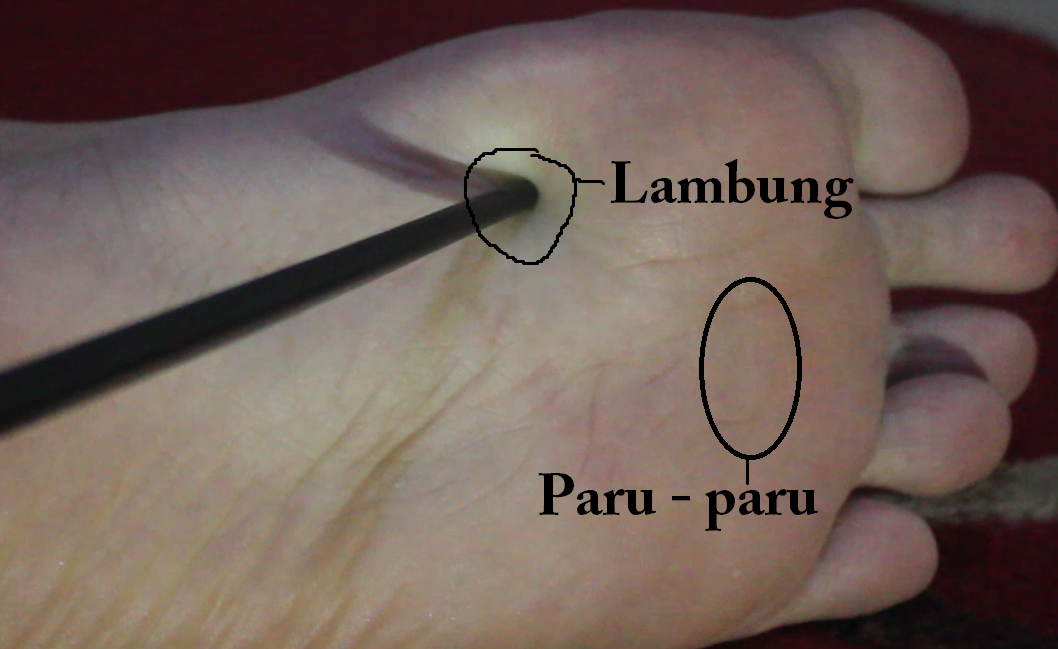 TITIK PARU - PARU DAN LAMBUNG